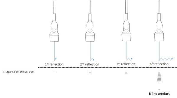 Thoracic Ultrasound Theory - FAMUS