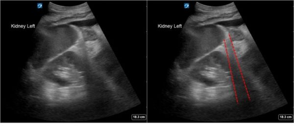 Ultrasound Theory Module - FAMUS