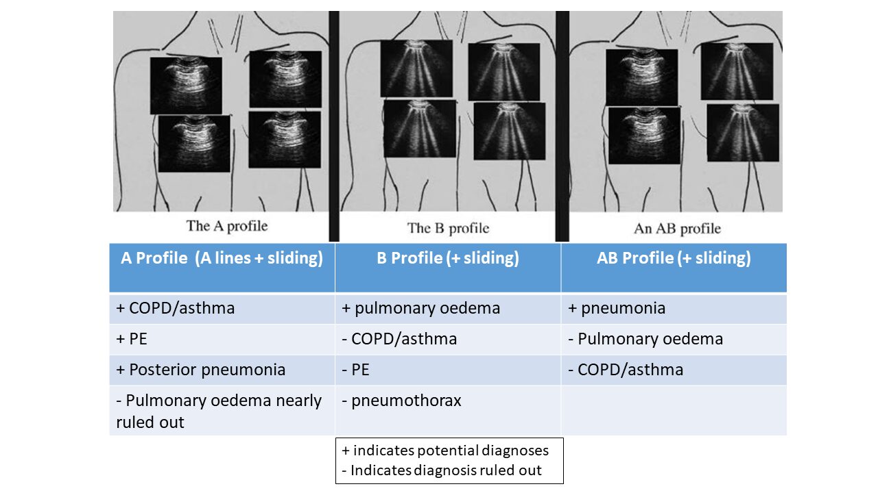BLUE Protocol - FAMUS