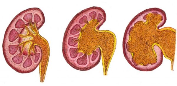 Abdominal-Renal Module - FAMUS